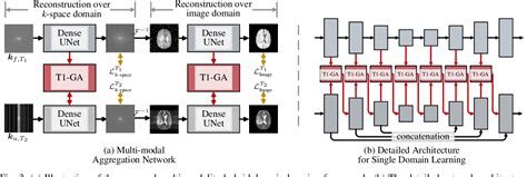 Figure 3 From Multi Modal Aggregation Network For Fast Mr Imaging Semantic Scholar