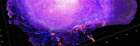 Tracking Inflammasome Activity Via Measuring Il 1β Levels With Alphalisa And Htrf Revvity