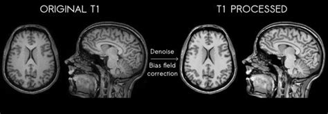 The Fast Fourier Convolution Network A Fast And Efficient Approach For Convolutional Neural