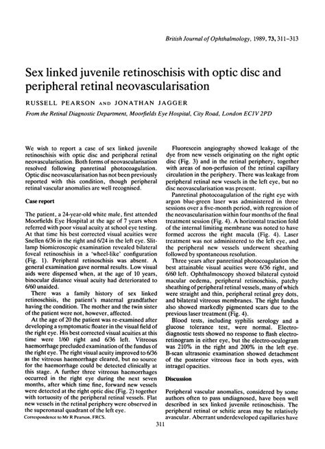 Sex Linked Juvenile Retinoschisis With Optic Disc And Peripheral Retinal Neovascularisation Pmc