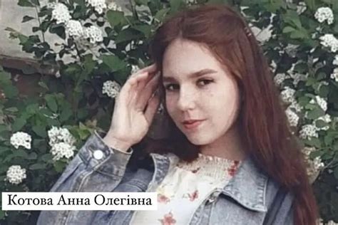 19-річна дівчина, яка залишилися без ока від удару РФ по Дніпру ...