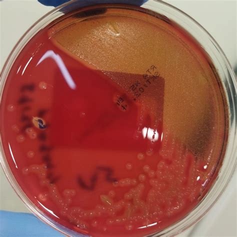 Uzmdrneriman T On Linkedin Streptococcus Pyogenes 🥰