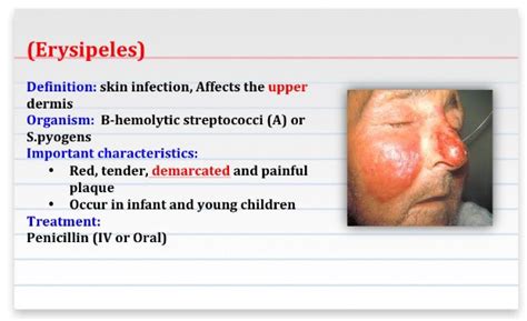 Erysipelas Vs Cellulitis