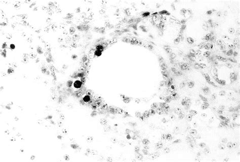 C Myc Induced Apoptosis In Sbm Transgenic Mice Apoptotic Nuclei Are Download Scientific