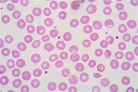 Morfología De Eritrocitos Foto De Stock Y Más Banco De Imágenes De 2015 2015 Alimento