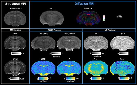 ex vivo scalar maps other dti metric maps such as axial and radial