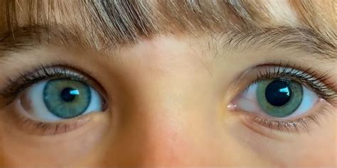 What Does It Mean When Pupils Are Small Important Information About Pupil Size Assil Gaur Eye