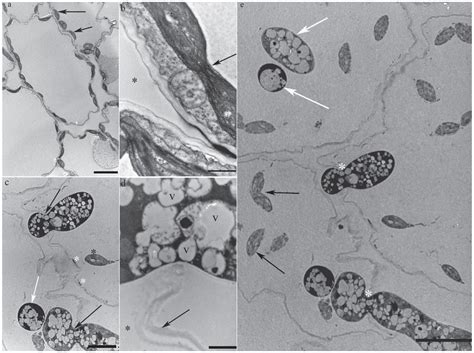 Morphological And Enzymatical Characterization Of The Infection Process Of Pythium Ultimum In