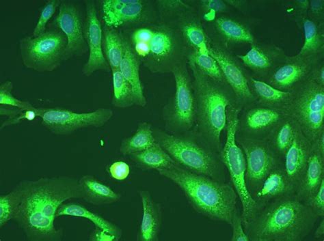 2d Automated Analysis Image Pro Media Cybernetics 2d Automated Analysis Image Pro Media Cybernetics