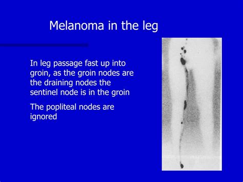 PPT Sentinel Nodes PowerPoint Presentation Free Download ID