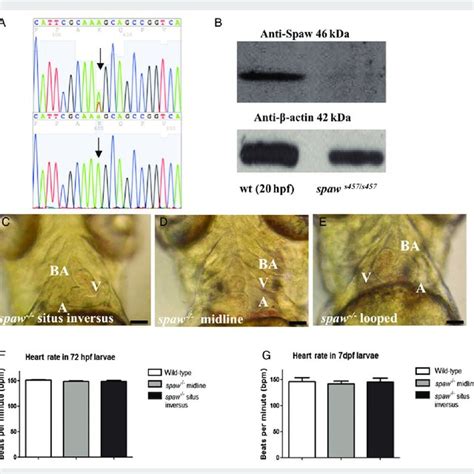 A Mutation In The Spaw Gene Causes Cardiac Laterality Defects S457