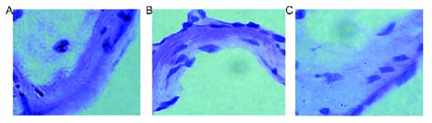 Hematoxylin And Eosin He Staining Of The Anterior Cerebral Download Scientific Diagram