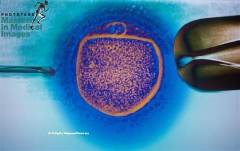 In Vitro Fertilization Microinjection Process