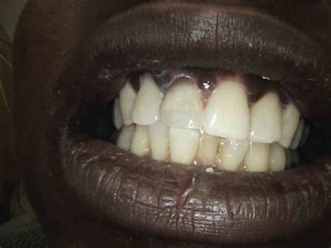 Dr Mitzi Ezzat Dental Office Dentist And Dental Office Winnipeg Manitoba Facebook 89 Photos