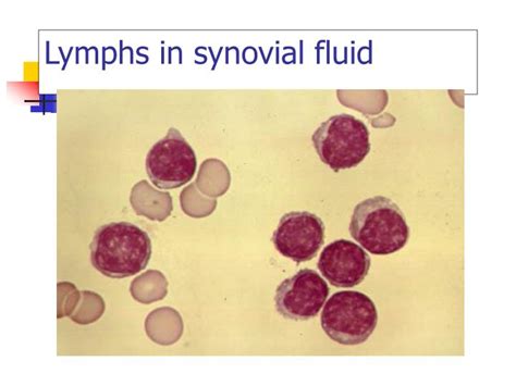 Ppt Synovial Fluid Powerpoint Presentation Id702385