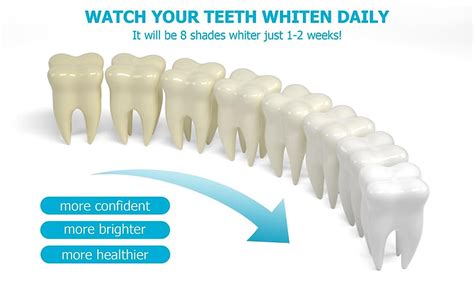 Teeth Whitening Ollm