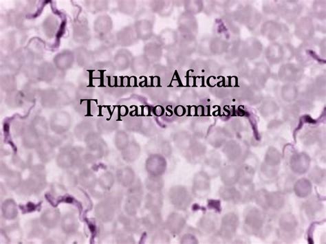 Human African Trypanosomiasis