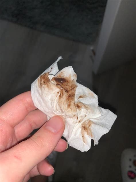 Brown Spotting When I Had My Period 2 Weeks Ago Rperiods