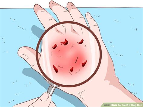 Нохойд хазуулсан бол анхаарах ЕСӨН зүйл