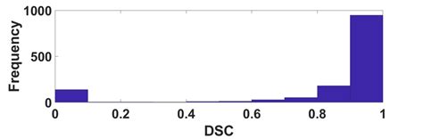Comparison Of The Non Bypass Input To All And Non Bypass Dense Models