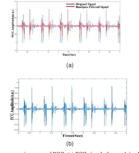 Figure 2 From Classification Of Short Unsegmented Heart Sound Based On Deep Learning Semantic