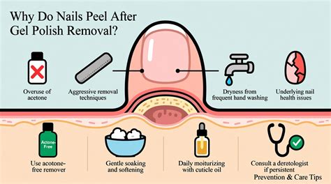 Why Do My Nails Peel After Removing Gel Polish Common Causes And Fixes