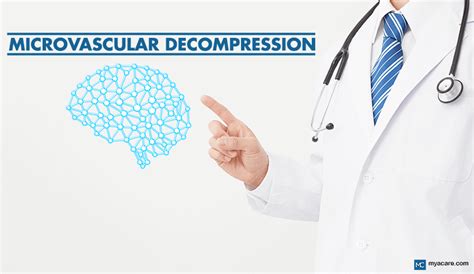 Microvascular Decompression Surgery For Nerve Pain Explained
