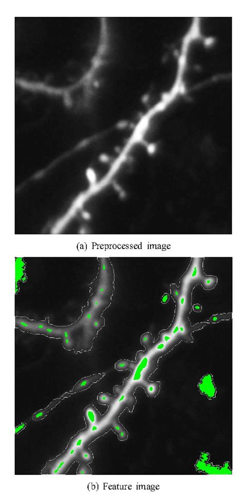 Figure 3 From A Tool For Automatic Dendritic Spine Detection And