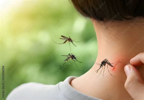 Dengue Mosquitoes Bite Background For Dengue Prevention Post Dengue Hospital Advertisement Stock