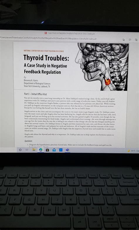 Case Study On Negative Feedback Regulation Extra Chegg