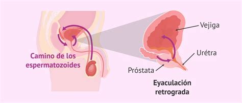 ¿qué Es La Eyaculación Retardada Guía De Salud Vidaliax