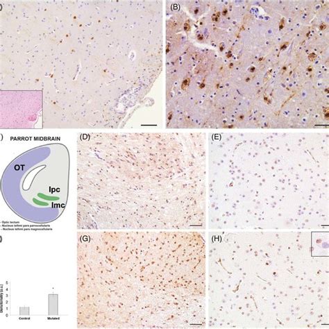 Transmission Electron Microscopy Of A Mutated Parrot Neuron A