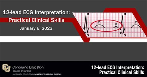 12 Lead Ecg Interpretation Practical Clinical Skills Cu College Of Nursing Aurora January 6