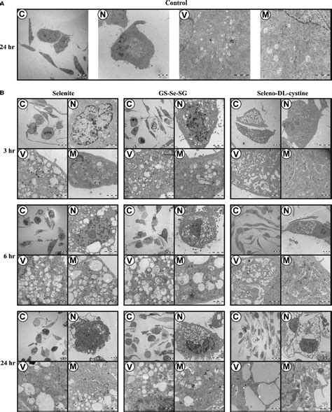 Stage 3 Papillary Thyroid Cancer
