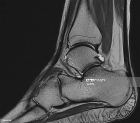 Mri Magnetic Resonance Imaging Of The Foot And Ankle High Res Stock
