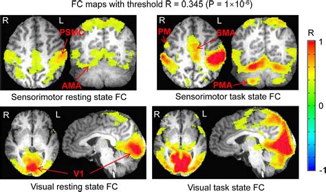 Frontiers The Relationship Of Functional Connectivity Of The