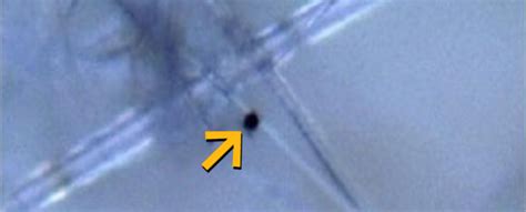Experiment Reveals Microplastics In Every Human Semen Sample Tested