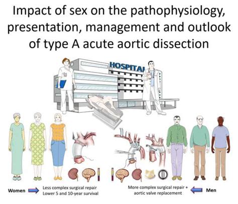 Giuseppe Biondi Zoccai On Linkedin Is Female Sex Impactful In The Pathophysiology Presentation