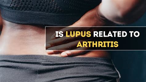 Is Lupus Related To Arthritis