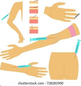 Injection Technique Images Stock Photos Vectors Shutterstock