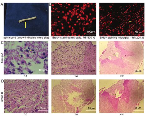 Tracing Of Transplanted Microglial Cells And Histological Staining Of