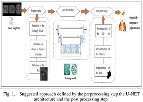 Figure 1 From A 3d Processing Technique To Detect Lung Tumor Semantic Scholar Figure 1 From A 3d Processing Technique To Detect Lung Tumor Semantic Scholar