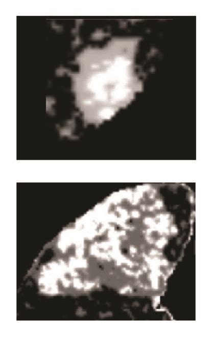 Intermediate Results Of The Initialization Of Graph Cuts Segmentation