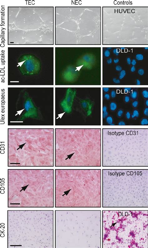 The Isolated Tumor And Normal Endothelial Cell Cultures Show