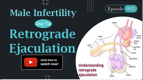 What Does Retrograde Ejaculation Feel Like? Causes Explained by Doctor ...