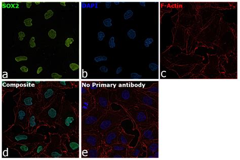 Sox2 Antibody Ma5 16399
