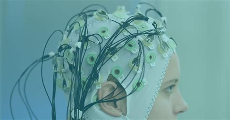 Brain Monitoring Systems Provide Many Benefits To Medical Professionals