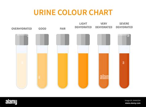 Urine Color Chart Illustration Of Dehydration Level Stock Vector Image