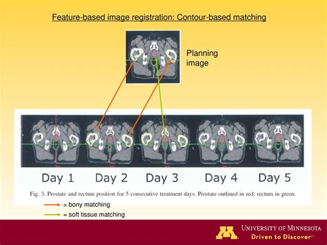 Mphy8149 Image Registration Ppt Download