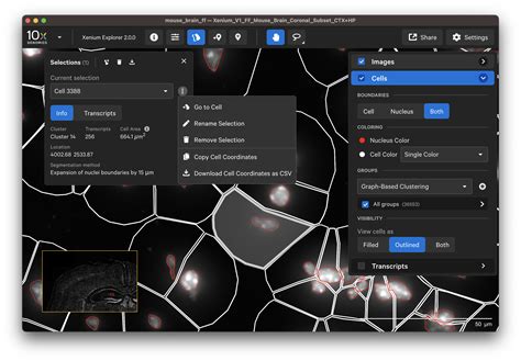 Checking Xenium Data Quality Official 10x Genomics Support
